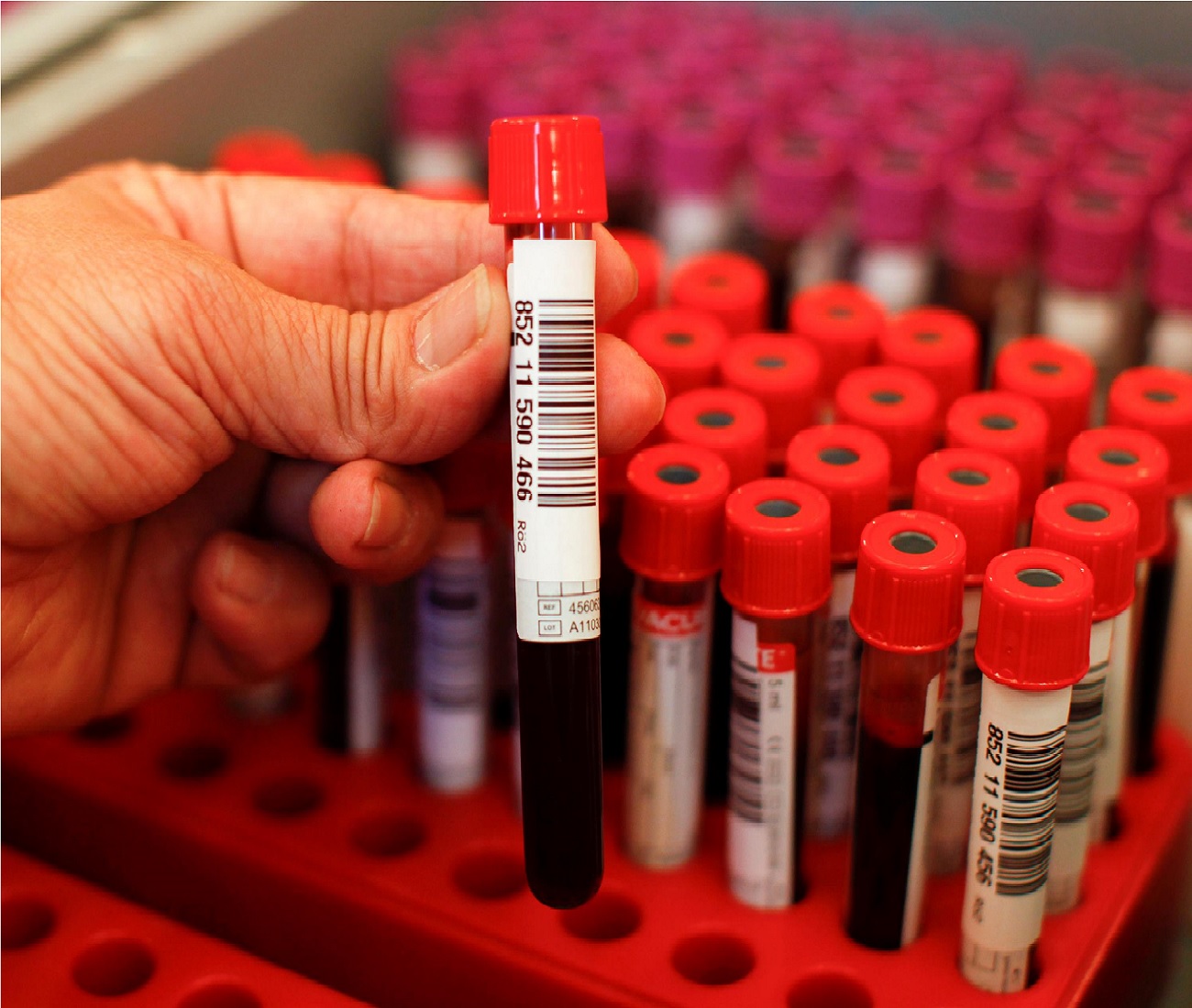 Protecting Against Blood and Other Potentially Infectious Materials ...