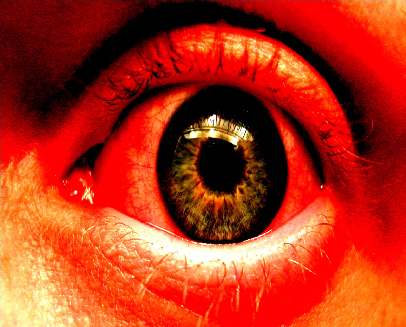 Keep a Lookout for Eye Injuries | SafetyNow ILT